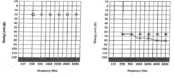 Rule 3 explained? Masking Training with TJ Audiology Training – TJ ...