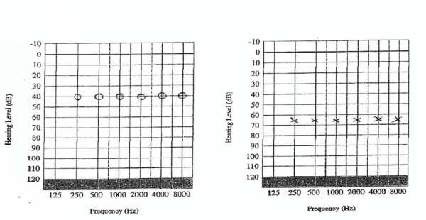 Rule 3 explained? Masking Training with TJ Audiology Training – TJ ...