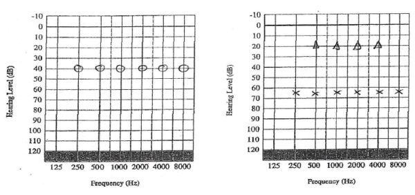 Rule 3 explained? Masking Training with TJ Audiology Training – TJ ...